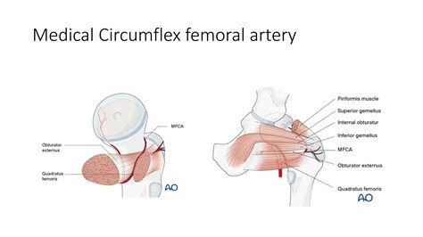 Acetabulum Fractures Anatomy Radiological Evaluation Classification And Management Pptx