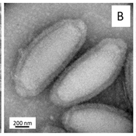 Transmission Electron Microscopy Of The Chlamydia Bacterium A And