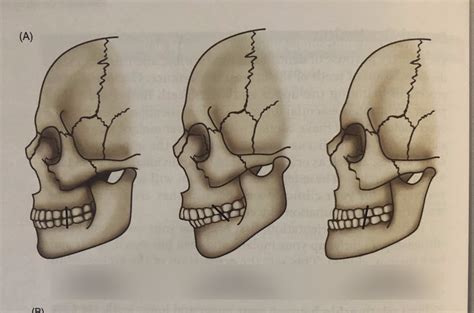 Dental Occlusion Diagram Quizlet