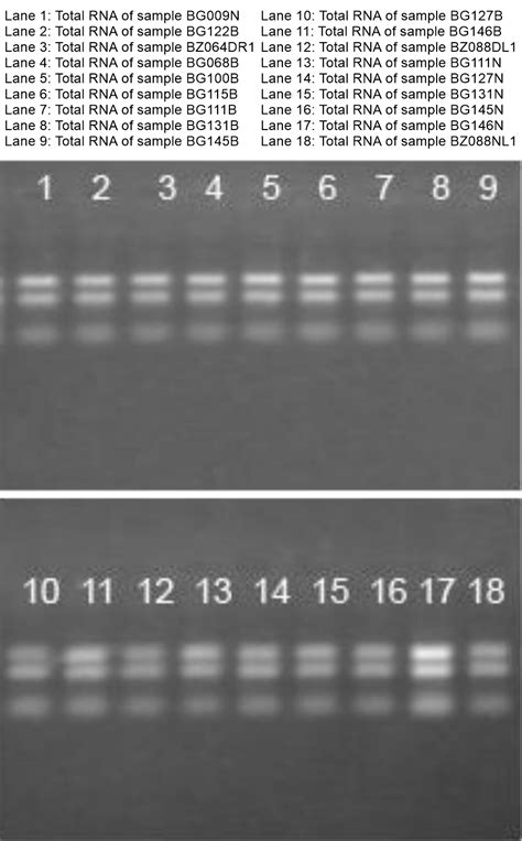 Microarray Profiling Of Circular Rnas In Human Papillary Thyroid