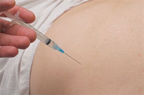 Illegal Buttock Injections Zuckerman Plastic Surgery New York