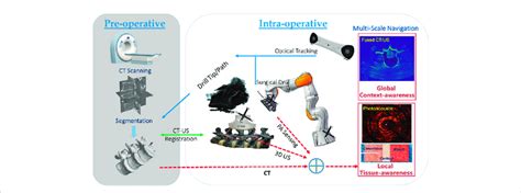 Multi Scale Surgical Navigation And Sensing Paradigm Based On Download Scientific Diagram