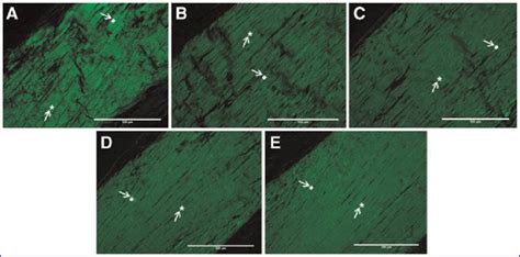 Quantitative Birefringence Measurements Showing The Organization Of Download Scientific Diagram