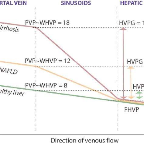 Hepatic Sinusoids In Healthy Liver And In Nafld A Schematic View Of