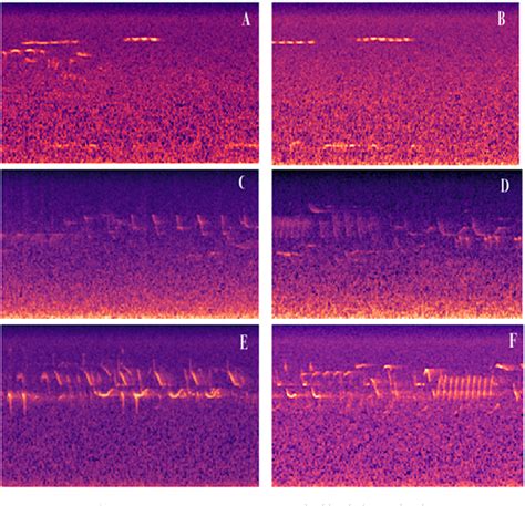 Figure 1 From An Explainable Artificial Intelligence Software System For Predicting Diabetes