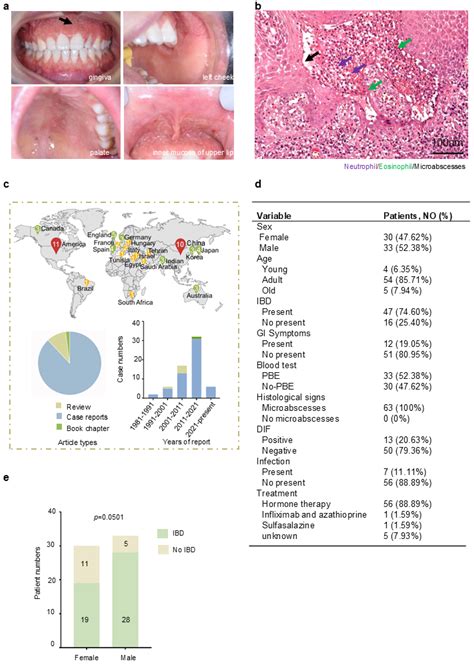 Pyodermatitis Pyostomatitis Vegetans The Role Of Langerin Deficiency