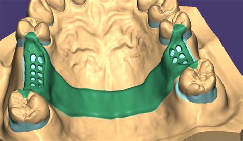 Exocad Wiki File RegistrazioneModelliExocadIta Exocad