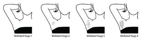 Male Armpit Hair Development