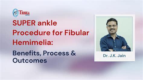 Super Ankle Procedure For Fibular Hemimelia Benefits Process And Outcomes Trishlaortho