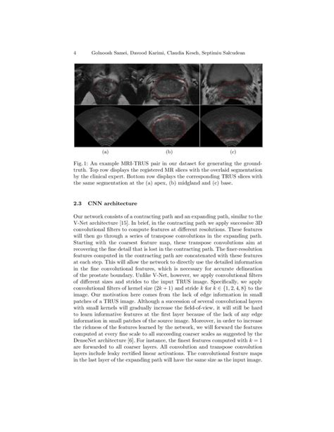Automatic Segmentation Of The Prostate On 3d Trans Rectal Ultrasound