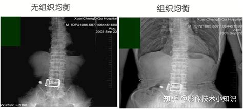 dr图像质量控制（2） 知乎