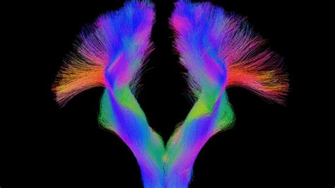 Clara For Medical Imaging AI Platform NVIDIA