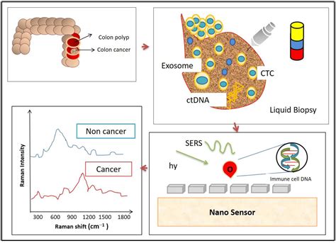 advancements in nanosensors for cancer detection