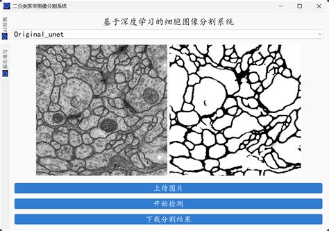【大作业 52】基于改进unet的细胞图像分割系统（unet、unet、r2net、attention Unet以及unet的改进）细胞分割系统 Csdn博客