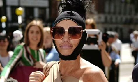 Katie Prices Plastic Surgeon Shares Concern Over Her New Facelift And