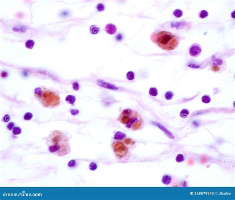 Macrophages Stock Image Image Of Microscopy Histopathology 268579943