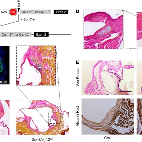 Increased Ca V 1 2 Expression In The Aortic Valve Is Causal For Cavd Download Scientific