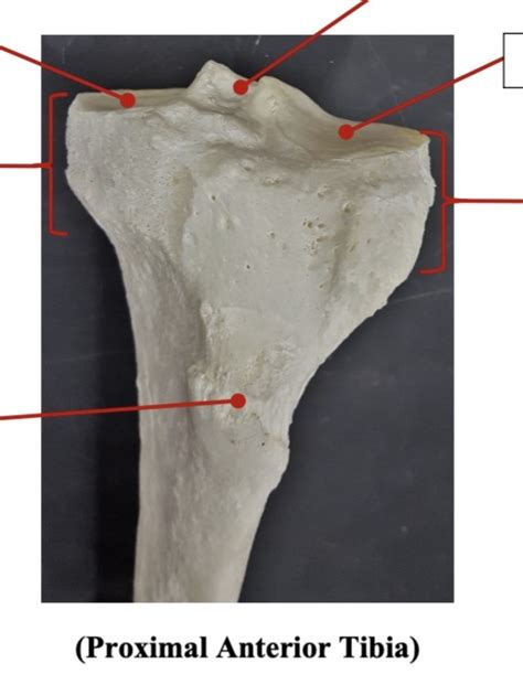 Proximal Tibia Diagram Quizlet
