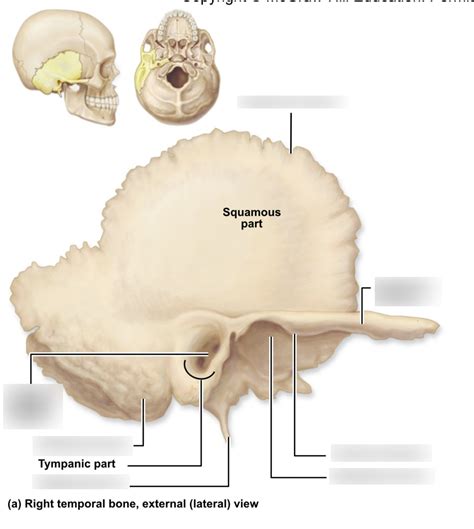 Anatomy Lab Axial Skeleton Temporal Bone Lateral Diagram Quizlet