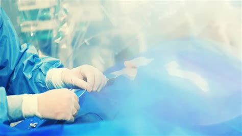 Myocardial Perfusion Scan