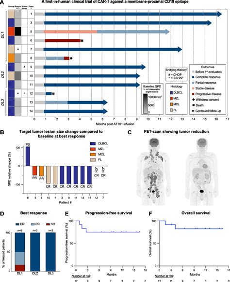Safety And Efficacy Of A Novel Anti Cd19 Chimeric Antigen Receptor T Cell Product Targeting A