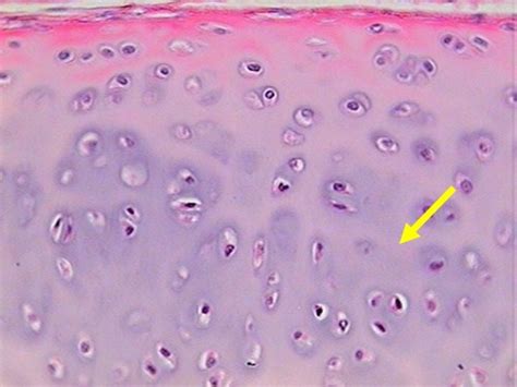 Matrix Collagen Salts In Bones Flashcards Quizlet