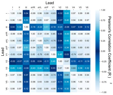 lead cross correlation matrix the cross correlation matrix quantifying