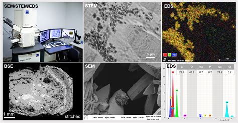 High Resolution Correlative Imaging Bbcmc