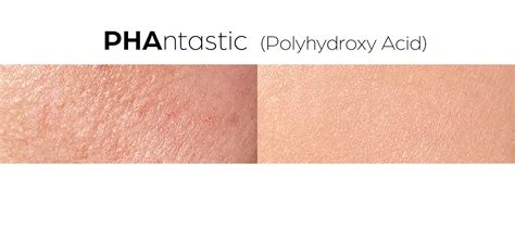 Phantastic Skincare Unlocking The Gentle Power Of Polyhydroxy Acids