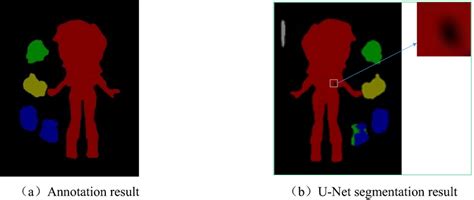 The Comparison Of The U Net Segmentation Result And The Annotation Result Download Scientific
