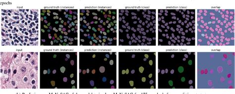Figure 2 From Combining Datasets With Different Label Sets For Improved