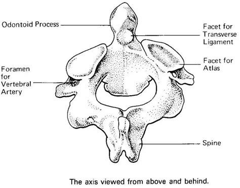 Pictures Of Axis Vertebra Odontoid Process