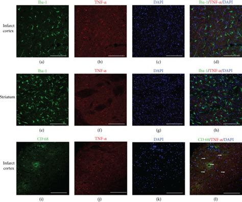 Cd68⁺ Microglia But Not Iba 1⁺ Cells Express Tnf α In The Ischemia