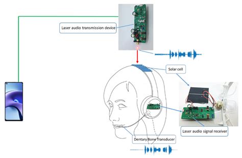 Sensors Free Full Text A Novel Dentary Bone Conduction Device Equipped With Laser
