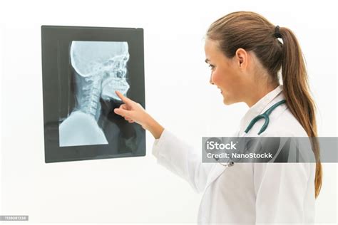 환자 머리의 엑스레이 필름으로 작업 하 고 두개골 부상을 진단 하는 여성 의사 의료 및 헬스케어 직원 서비스 개념 X 레이에 대한 스톡 사진 및 기타 이미지 Istock