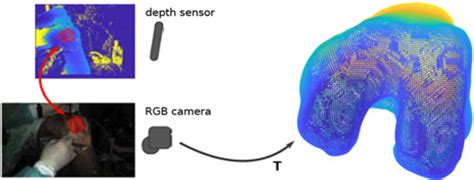 diagram of the proposed method bone segmentation is performed using