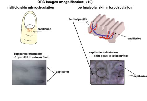 Microcirculatory Images Created By Orthogonal Polarization Spectral Download Scientific Diagram