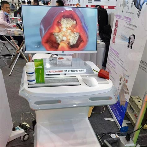 Low Cost High Definition Biopsy Colposcopy Cervical Hpv Exam Colposcope Machine Colposcope And