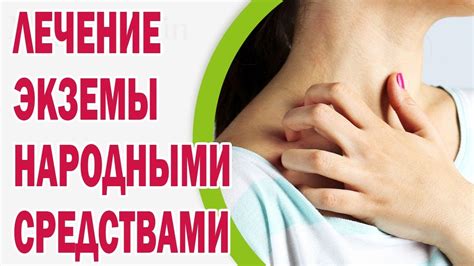 Лечение экземы народными средствами в домашних условиях - YouTube