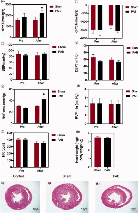 Functional Characterizations Of The PAB Model A DP DT B DP DT Download Scientific