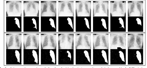 Figure 1 From Generative Adversarial Network Based Synthesis For Supervised Medical Image