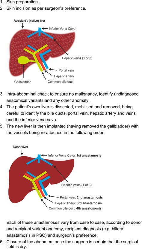 Order Of Liver Transplantation Surgery Psc Primary Sclerosing