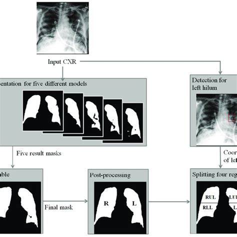 A Flowchart Of The Proposed Algorithm For Segmentation Of Zones Of The