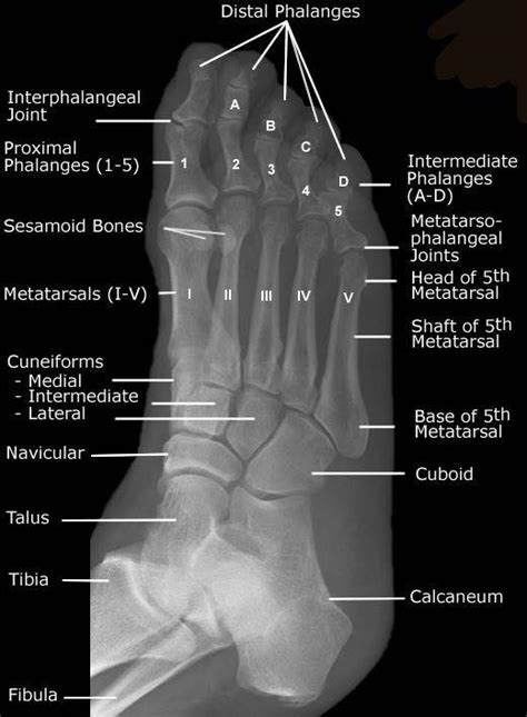 Medpic Medpic Added A New Photo