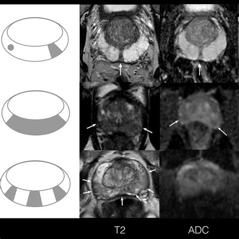 Bar Charts Showing The Median Psa Density Comparison Between The Download Scientific Diagram