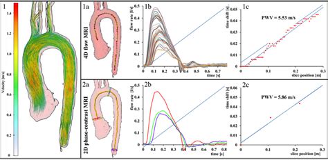 Pulse Wave Velocity Calculations Based On 4d Flow Mri And 2d