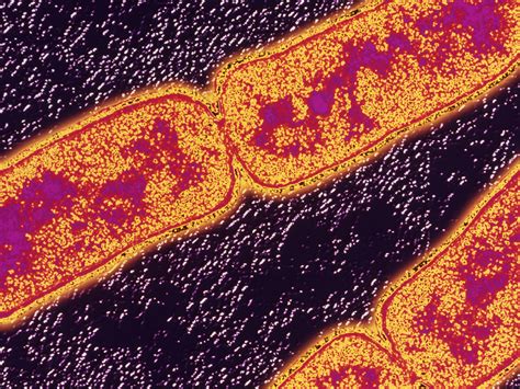 Latent TB Detection QuantiFERON TB Gold Plus Vs QuantiFERON TB Gold In Tube Infectious