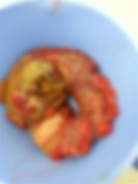 This Is What A Ruptured Sigmoid Colon Looks Like Nsfw Wtf