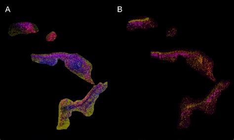 spatial molecular architecture of the microbial community of a