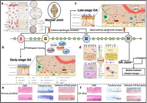 An Overview Of Oa Pathogenesis Treatment Phenotypes And The Download Scientific Diagram
